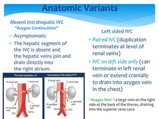 Inferior Vena Cava Disorders | PPTX
