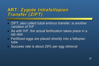 Zygote Intrafallopian Transfer