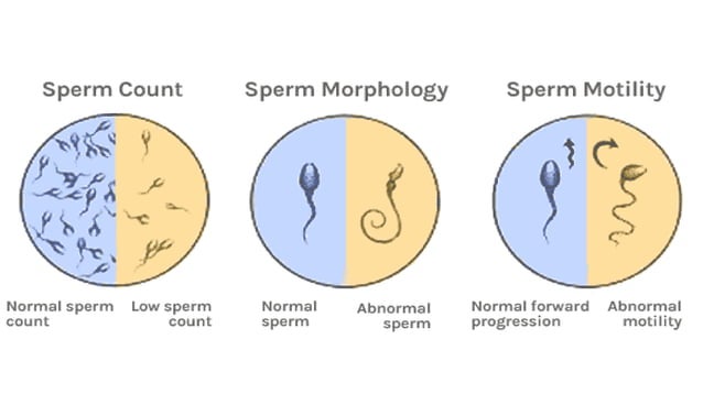 Pathophysiology of Infertility | PDF | Infertility | Reproductive Health