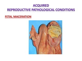 infertility.pptx