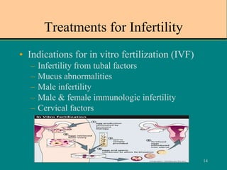 infertility.ppt