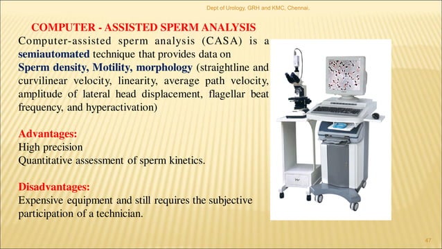 Infertility evaluation- semen analysis | PDF | Infertility | Reproductive Health