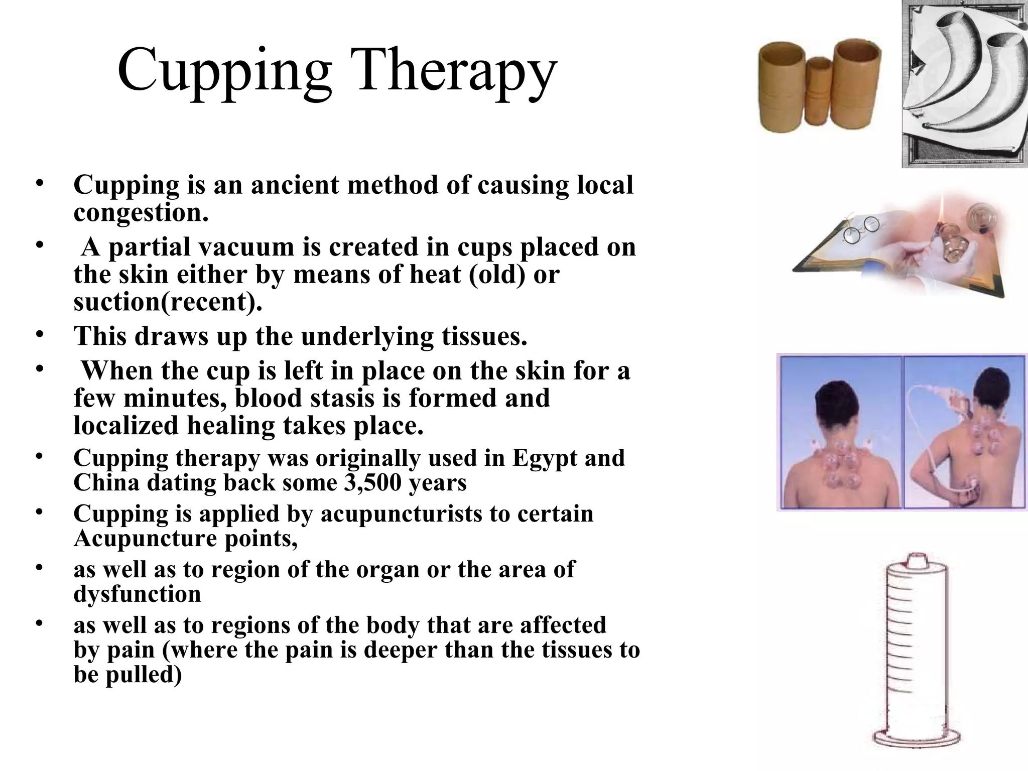 Infertility and cupping | PPT