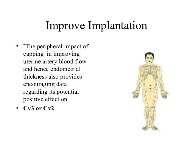 Infertility and cupping