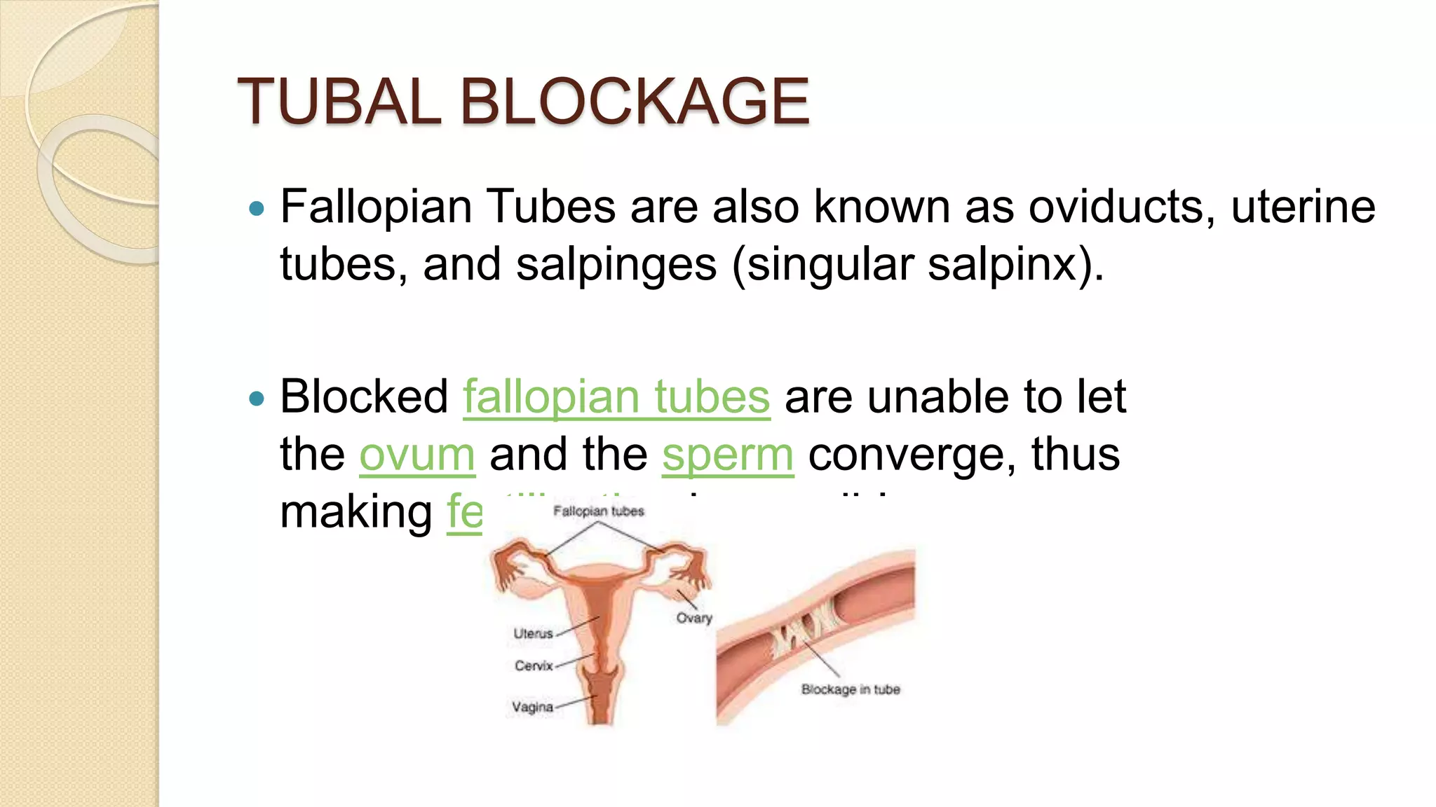 Infertility- A CASE DISCUSSION | PPTX