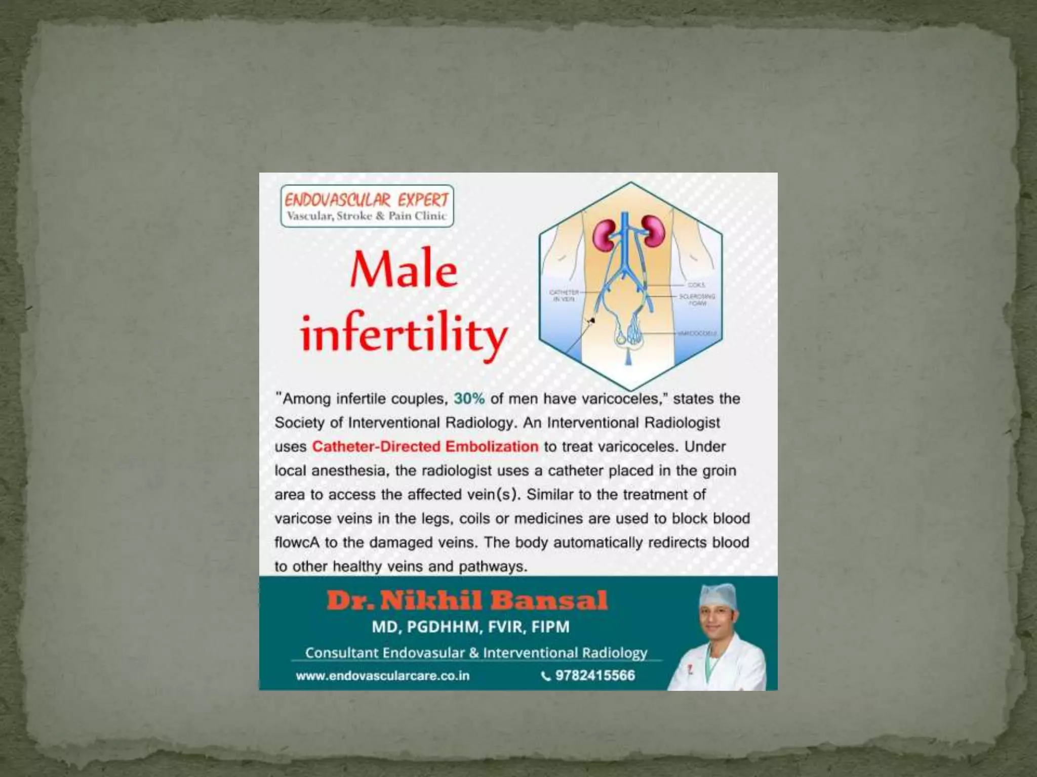 Infertility treatment Dr Nikhil Bansal interventional radiology | PPT Infertility treatment Dr Nikhil Bansal interventional radiology | PPT