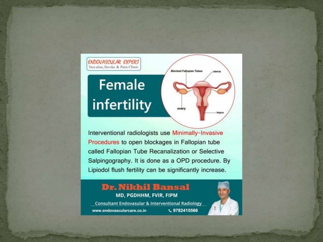 Infertility treatment Dr Nikhil Bansal interventional radiology | PPT Infertility treatment Dr Nikhil Bansal interventional radiology | PPT