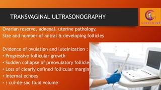 Infertility Workup.pptx