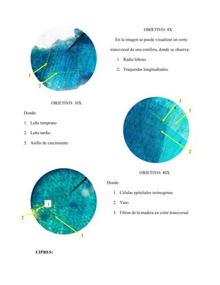 Estructura Anatómica, Microscópica coníferas y Latifoliadas | PDF