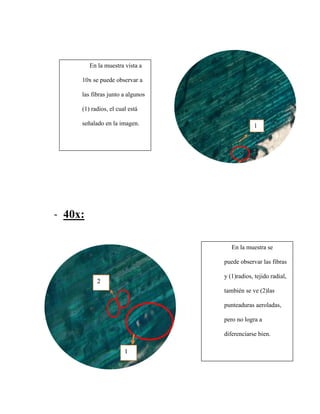 Estructura Anatómica, Microscópica coníferas y Latifoliadas | PDF