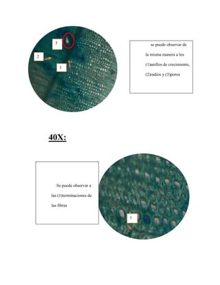 Estructura Anatómica, Microscópica coníferas y Latifoliadas | PDF
