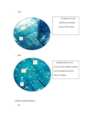 Estructura Anatómica, Microscópica coníferas y Latifoliadas | PDF