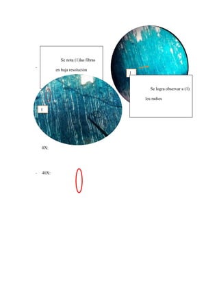 Estructura Anatómica, Microscópica coníferas y Latifoliadas | PDF