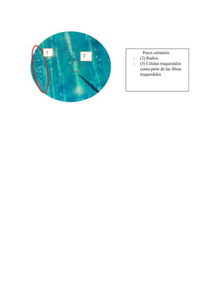Estructura Anatómica, Microscópica coníferas y Latifoliadas | PDF