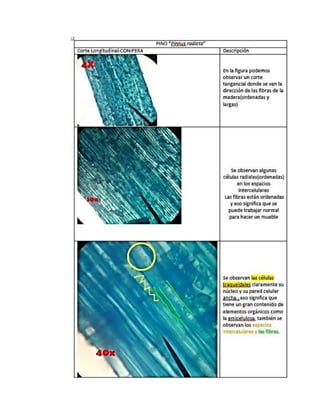 Estructura Anatómica, Microscópica coníferas y Latifoliadas | PDF