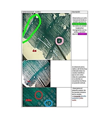 Estructura Anatómica, Microscópica coníferas y Latifoliadas | PDF