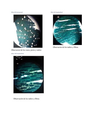 Estructura Anatómica, Microscópica coníferas y Latifoliadas | PDF