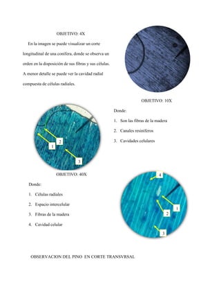Estructura Anatómica, Microscópica coníferas y Latifoliadas | PDF