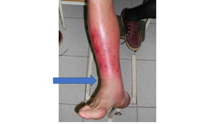 Infezioni della cute e del sottocute.pptx