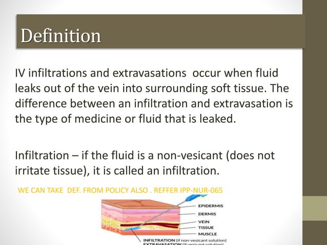 infiltration and extravasation.pptx