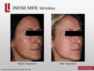 Infini BA photos | PDF