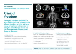 Infinity brochure | PDF