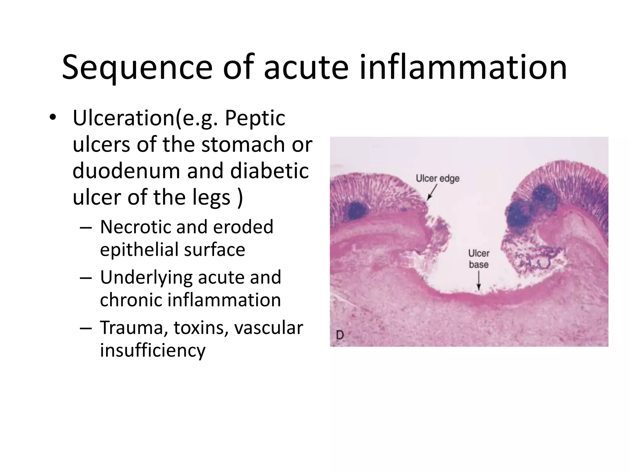 Inflammation | PPTX