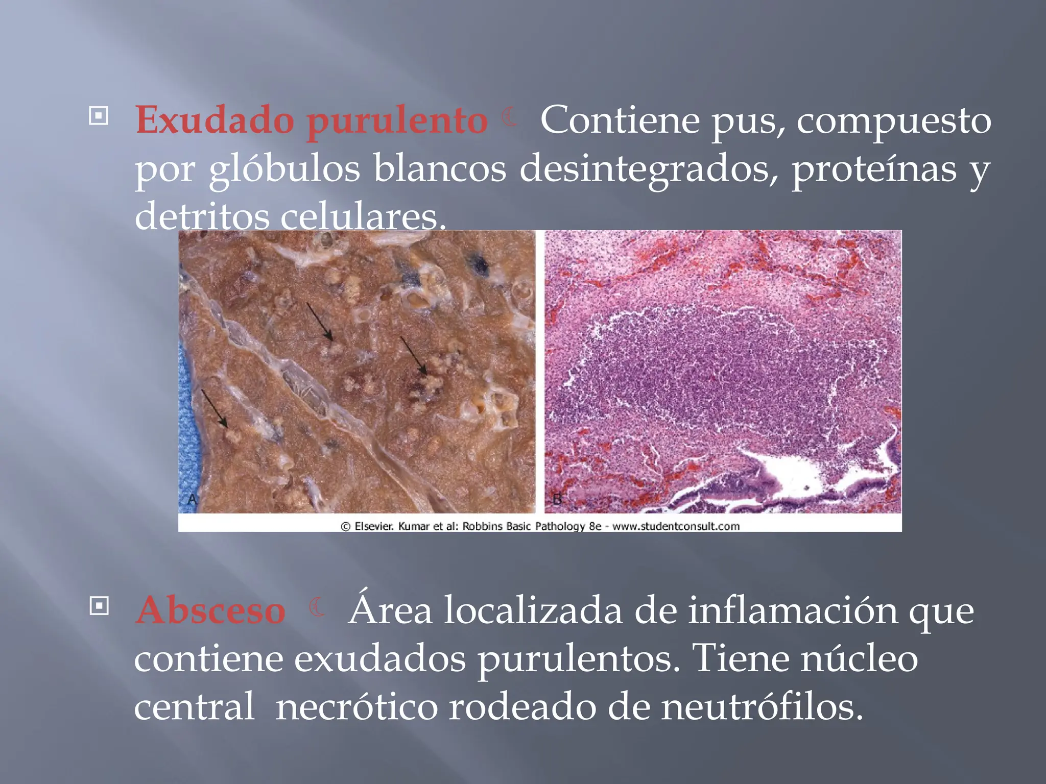 CASCADA DE INFLAMACION EN RESPUESTA .... | PPTX