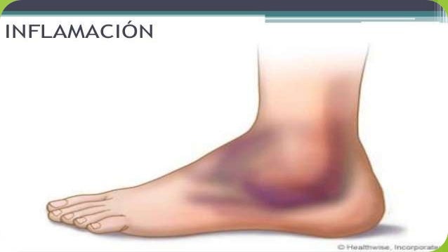 Inflamación