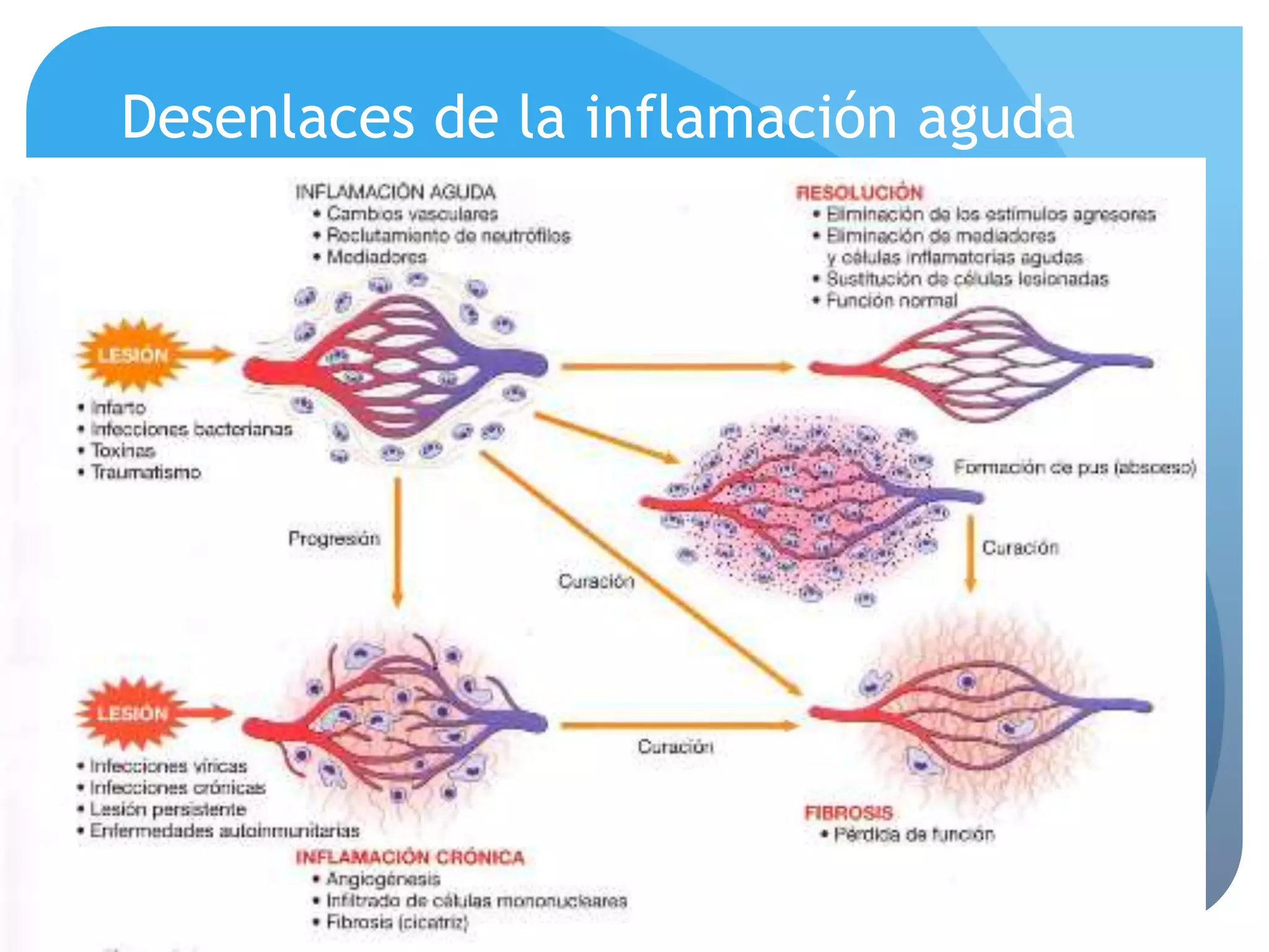 Inflamación aguda (patología) | PPTX