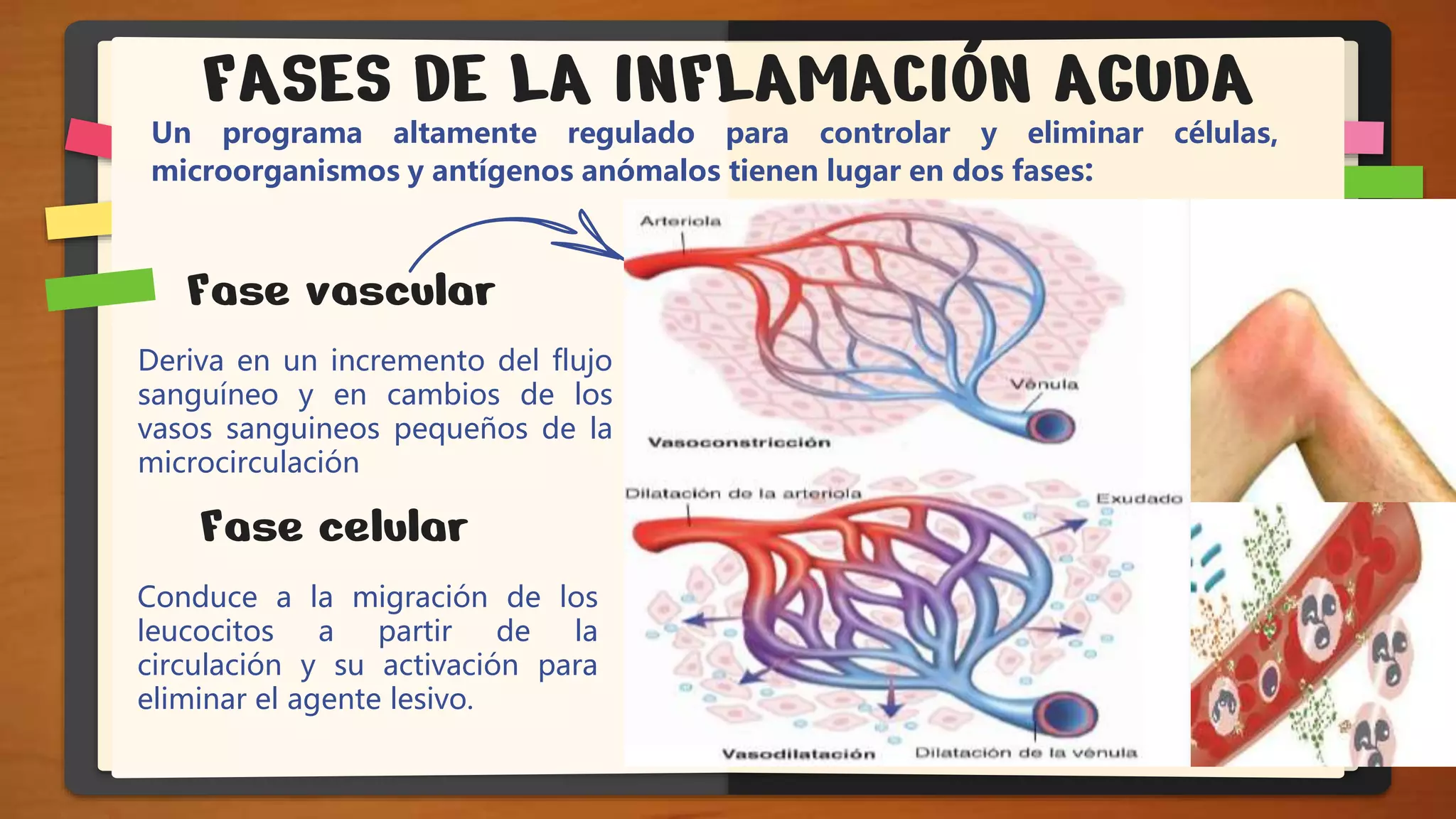 INFLAMACIÓN Y EDEMA_RONALDO ARATH ESPINOZA MARTÍNEZ.pptx