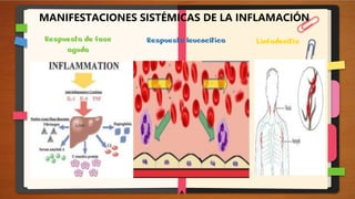 INFLAMACIÓN Y EDEMA_RONALDO ARATH ESPINOZA MARTÍNEZ.pptx