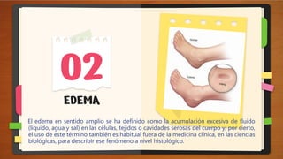 INFLAMACIÓN Y EDEMA_RONALDO ARATH ESPINOZA MARTÍNEZ.pptx