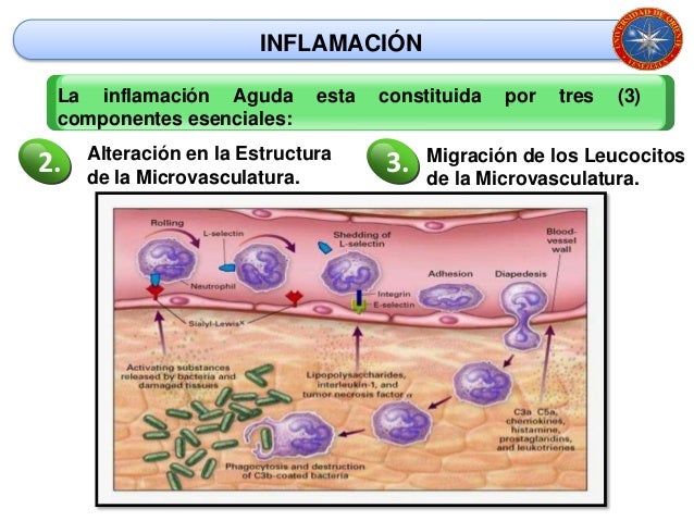 Inflamacion