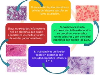 Inflamacion | PPTX