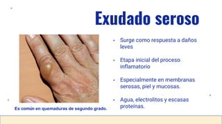 Inflamacion | PPTX