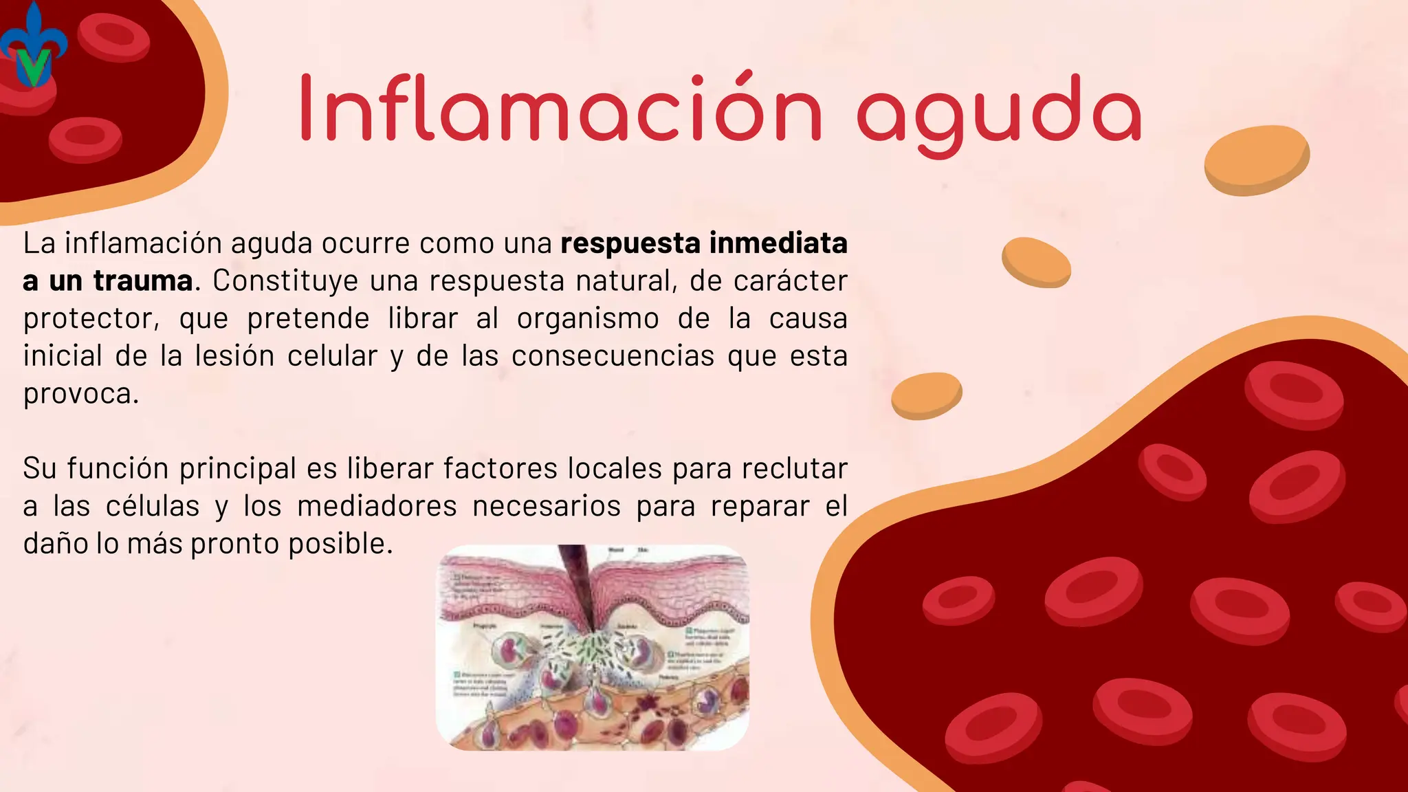 Inflamacion aguda - patologia general medicina | PPTX