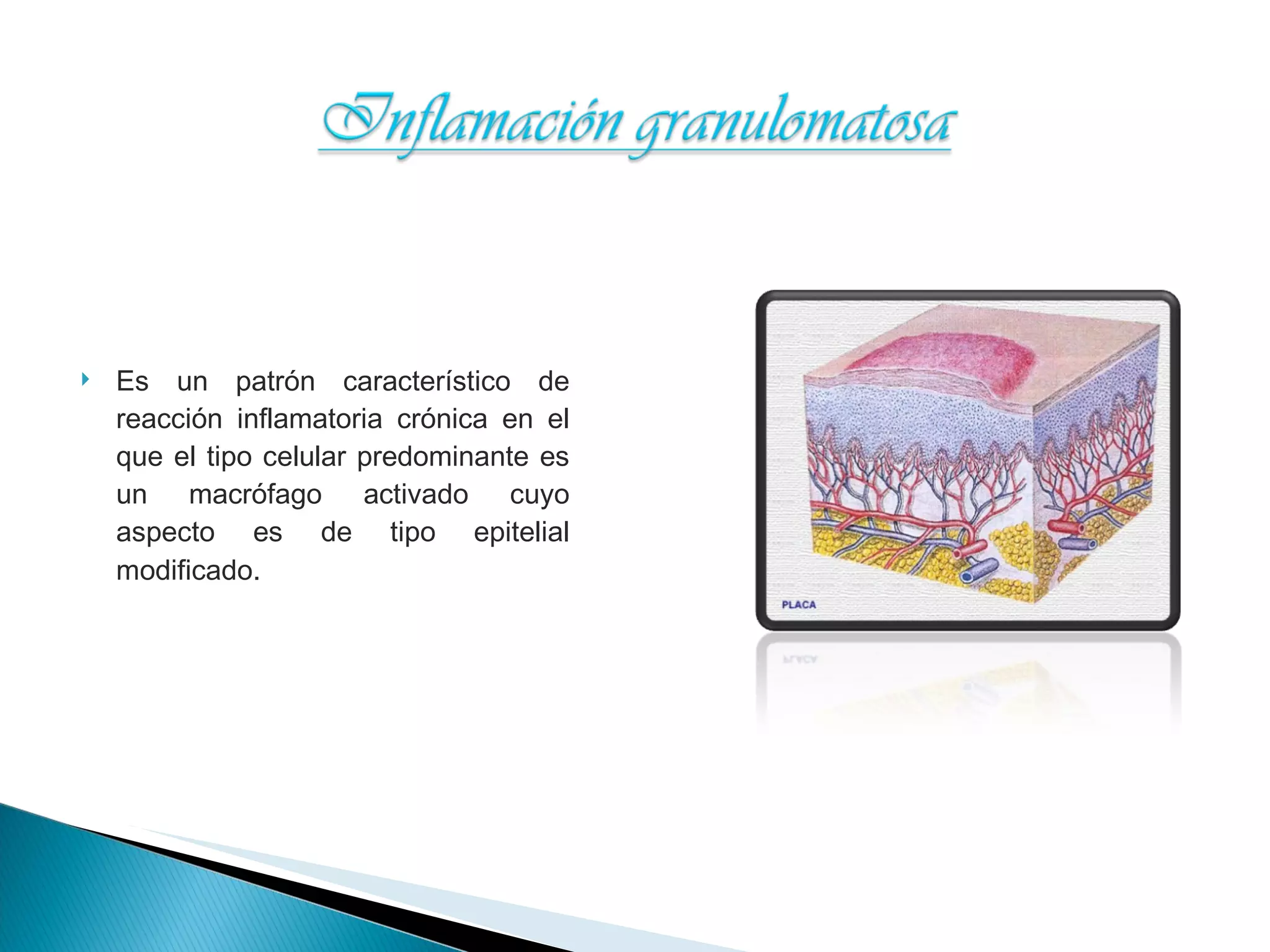 Inflamacion aguda y cronica | PPT | Medical Health