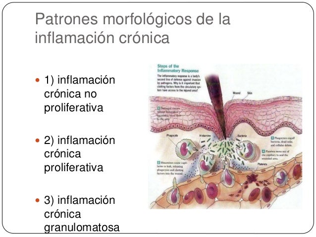 Inflamacion cronica