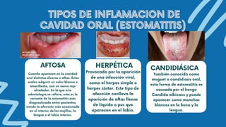 Inflamación Expo Inmunología odontología | PDF