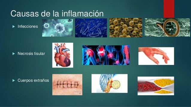 Inflamación Anatomía patológica y quirurgica