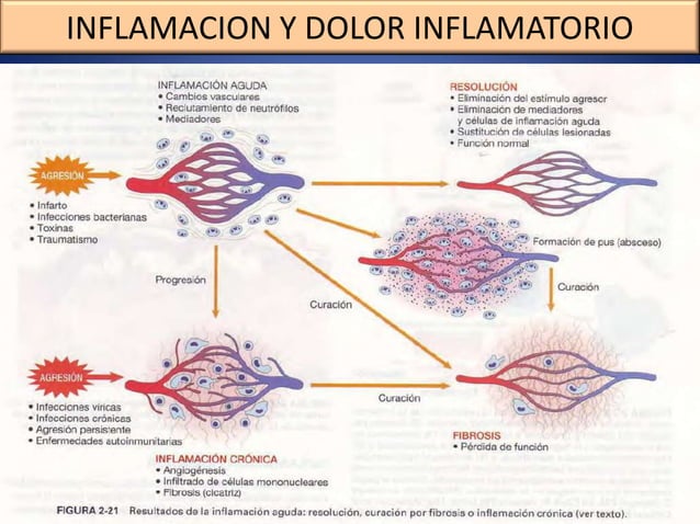 Inflamacion y dolor | PPT | Descarga gratuita