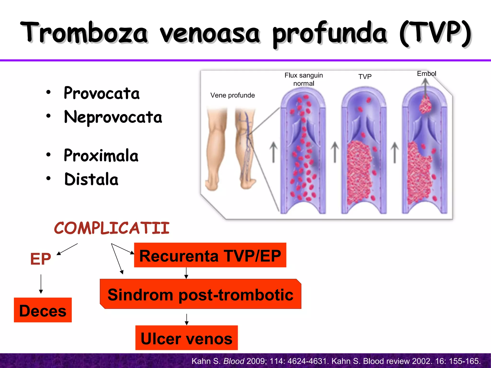 Inflamatia in TVP | PPT | Blood Disorders | Diseases and Conditions