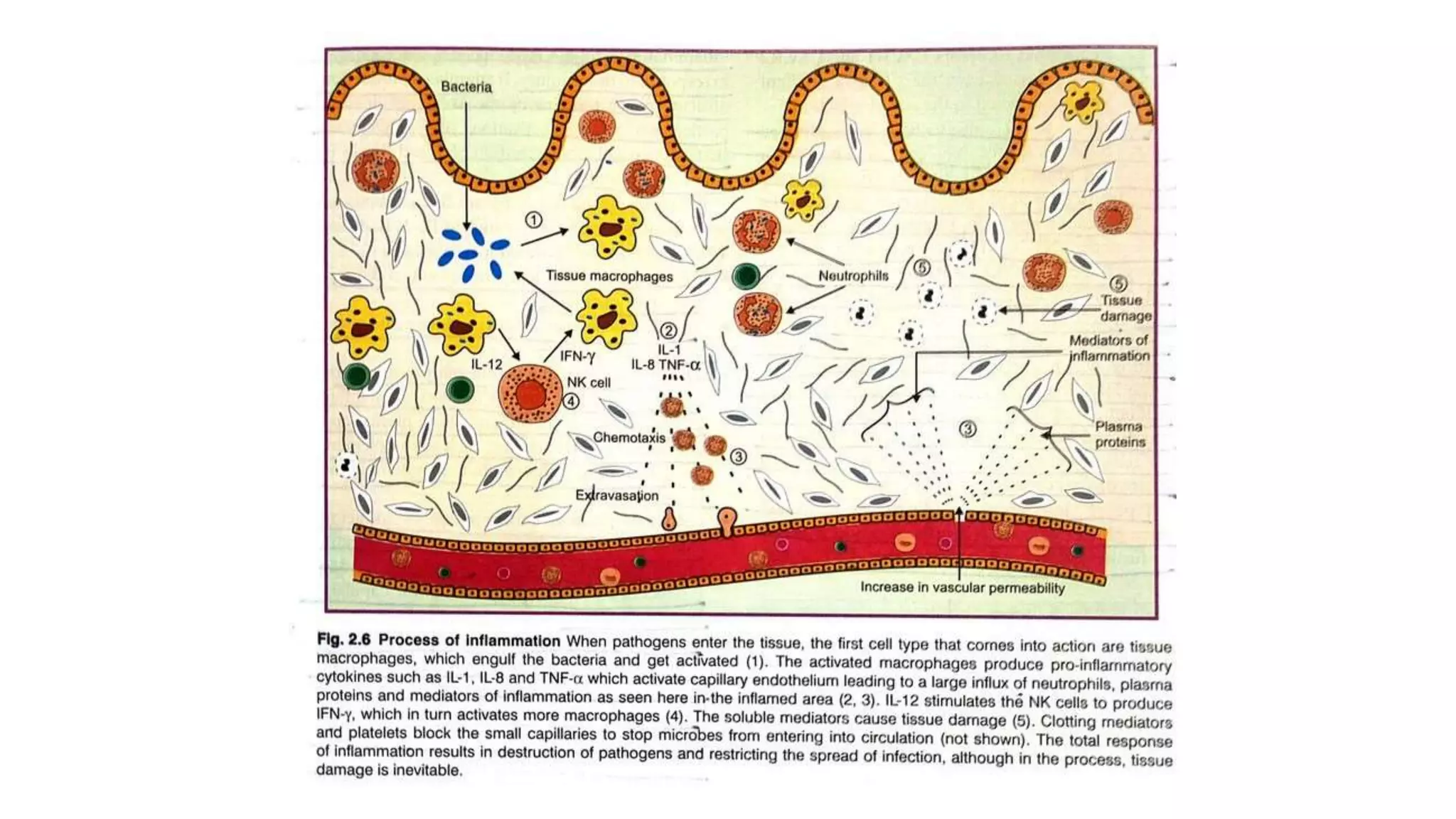 inflamation.pptx