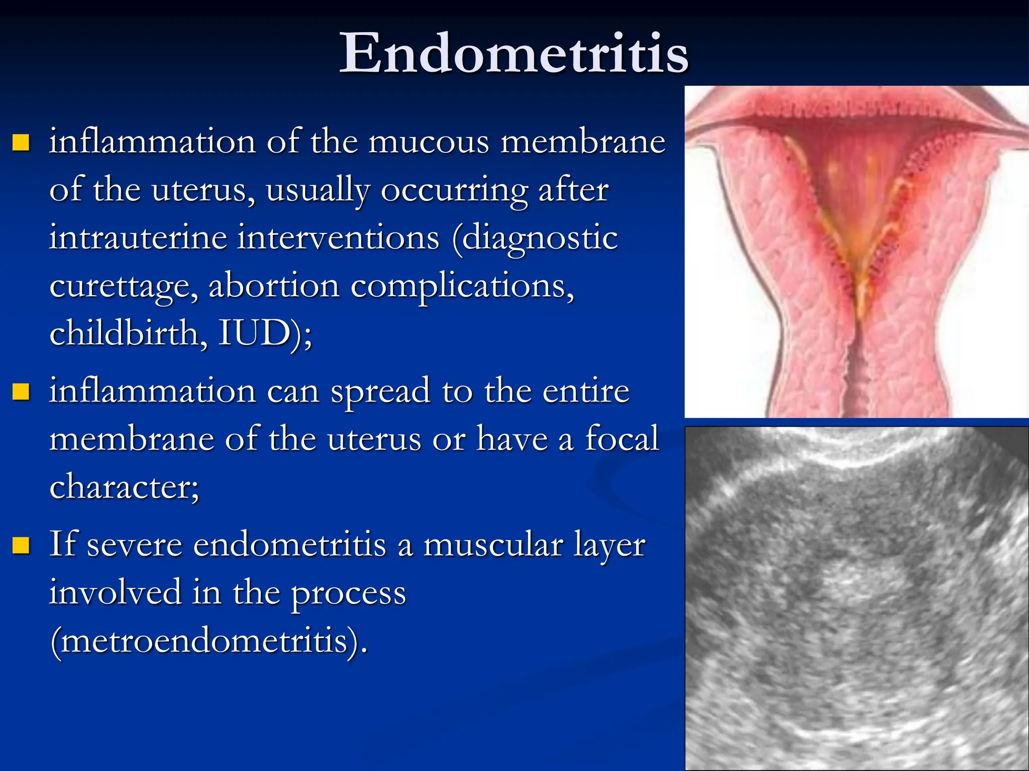 Inflamation_infertility.pdfdeals with inflammatory gynac | PDF