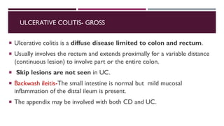 INFLAMATORY BOWEL DISEASE .pdf