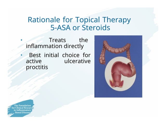 INFLAMATORY BOWEL DISORDER [IFD] .ppt