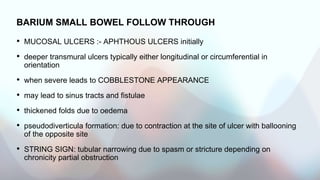 INFLAMATORY BOWL DISEASE orals.pptx