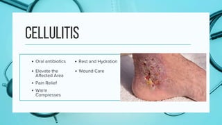 inflamatory diseases final of the skin... | PDF