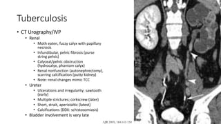 Inflammatory diseases of the kidney Part 2 | PDF